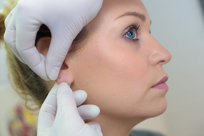 Lakukan Ini untuk Atasi Infeksi pada Tindikan Kuping